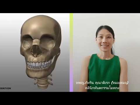 TMD คืออะไร? หมอเหมย จากคลินิกทันตกรรมโมทากะ เชียงใหม่ เซนเตอร์ V Shape Aligner มาอธิบายให้ฟัง ...